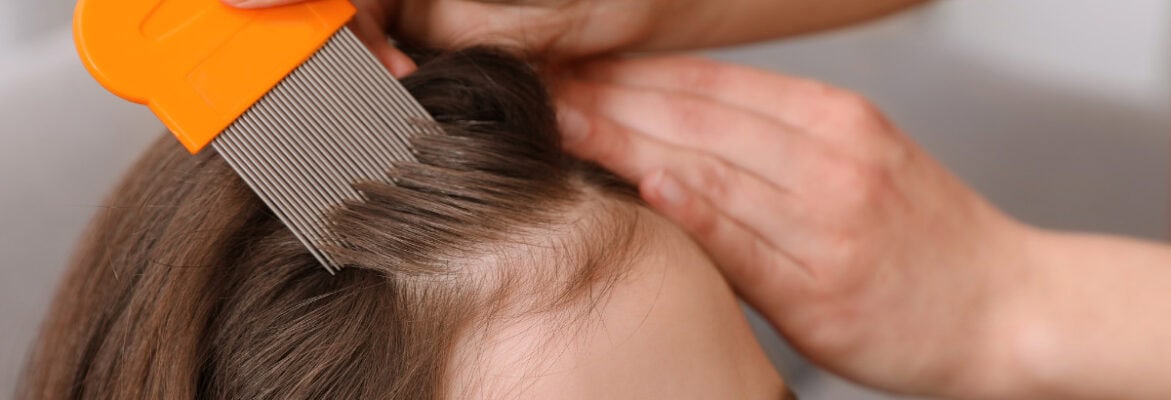 Luizen en haar: complete gids en plan van aanpak om ze voorgoed te ...